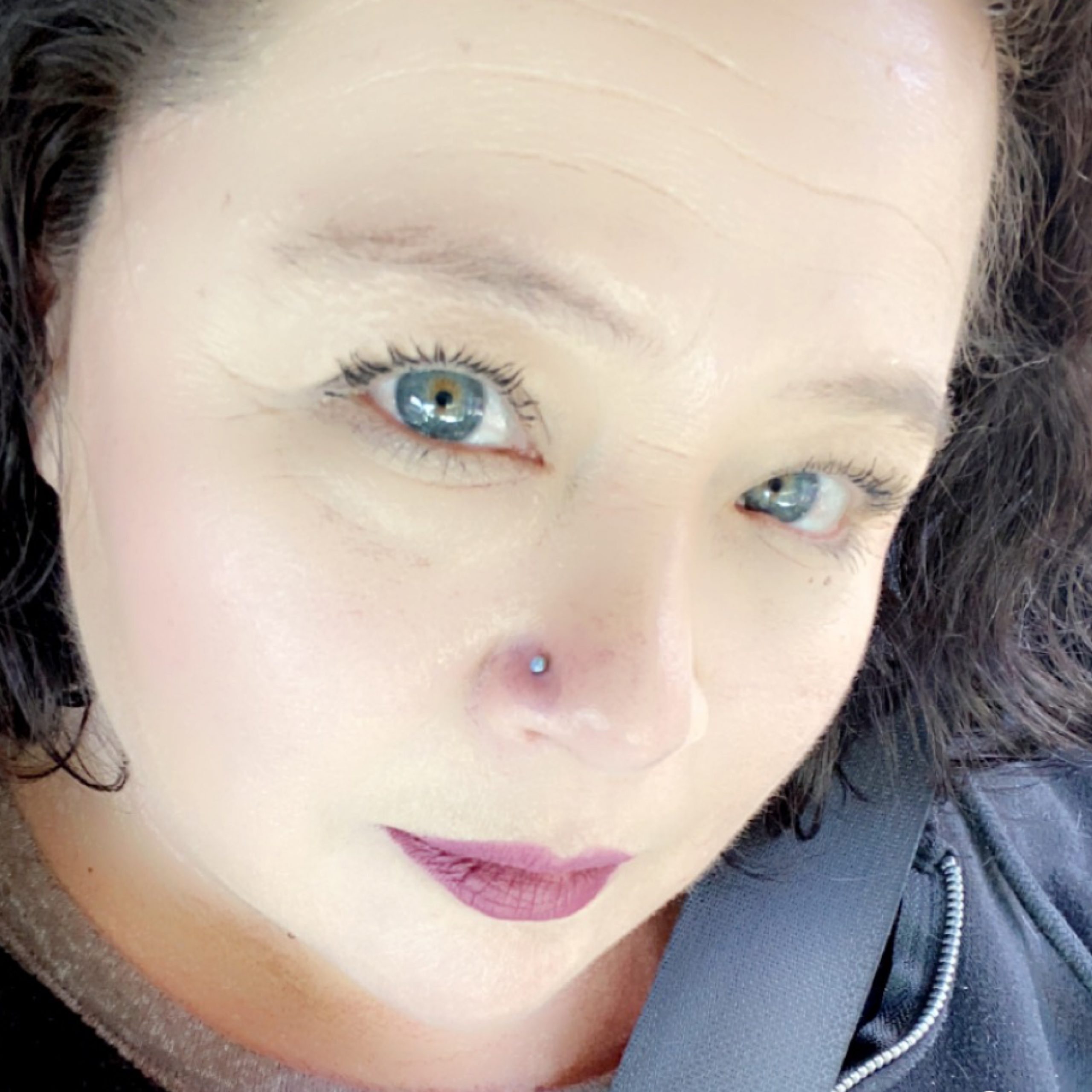 Living with Type 1 Gaucher Disease - Major Pain